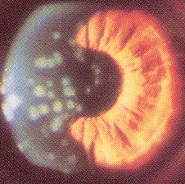 Comprehensive Eye Services | Eye Care | Master Eye Associates